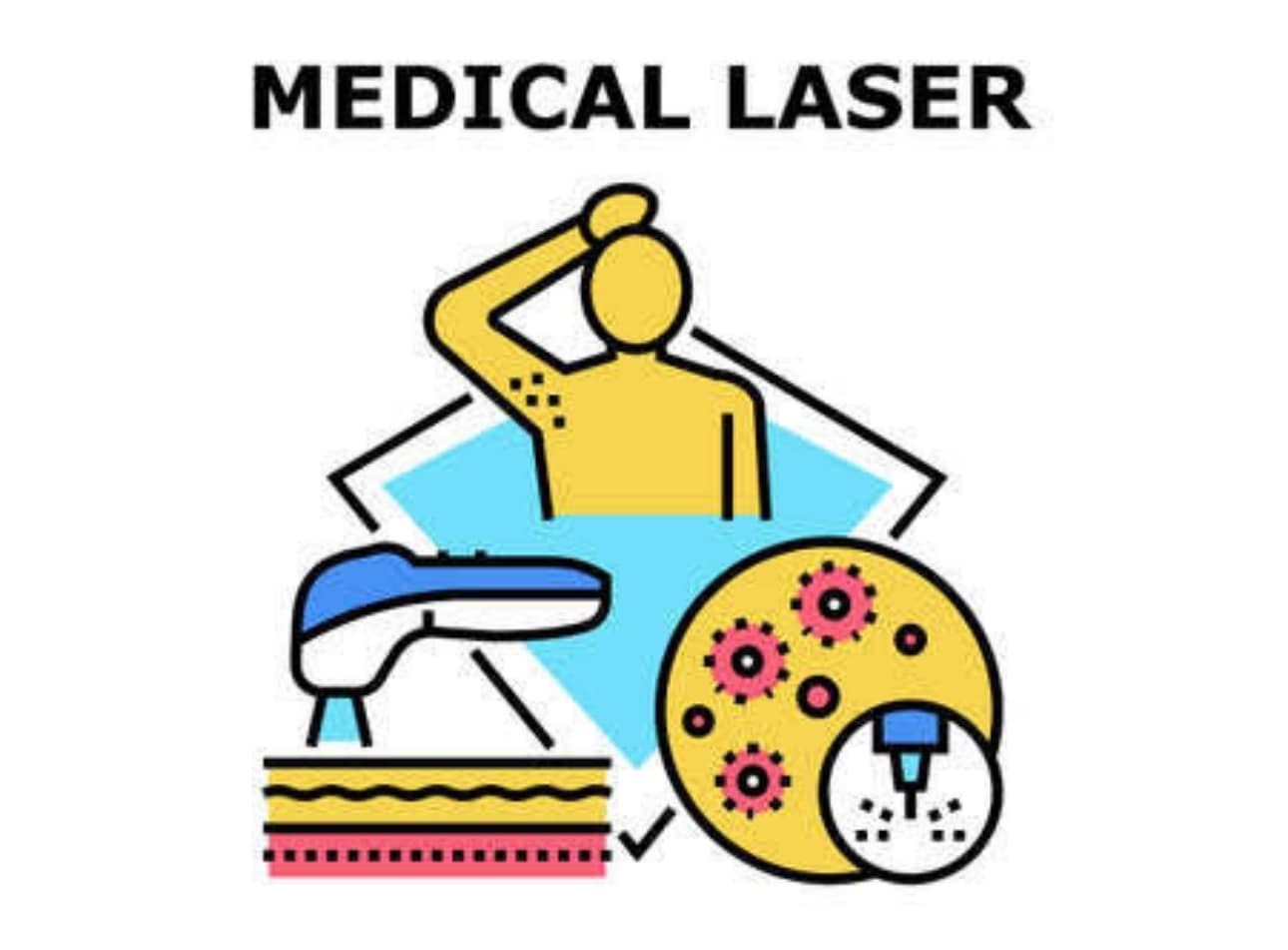Laser Hair Removal (Half Hand) – Celeb Laser Clinics